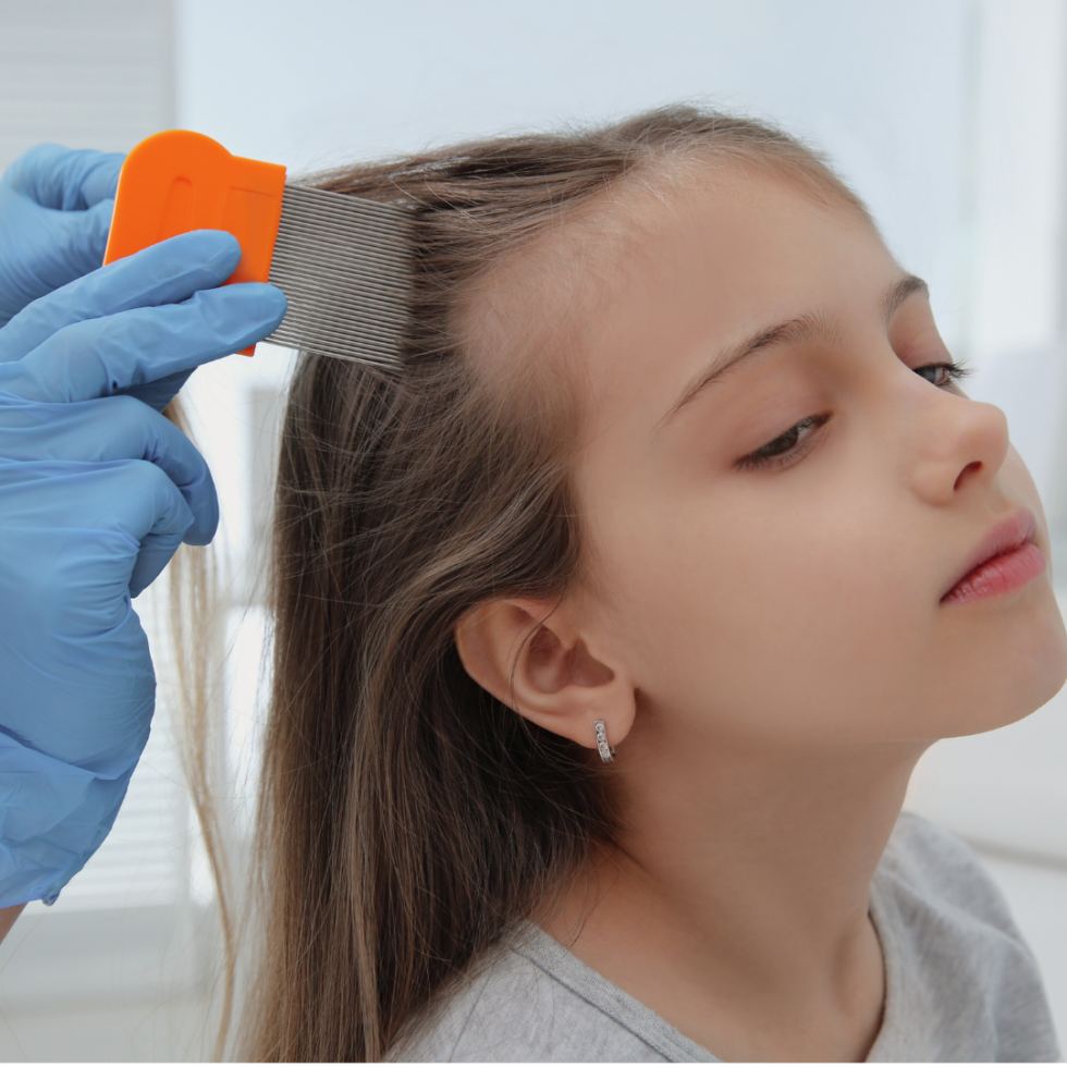 Head Lice: How to Prevent & Treat These Hair Pests! - Newtown Moms